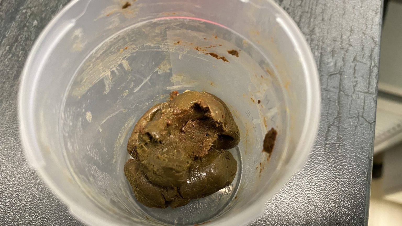 Qué color son las heces cuando hay parásitos y su importancia