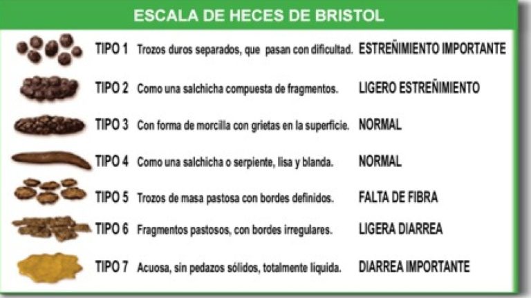 Qué significa el color de tu caca y su impacto en la salud
